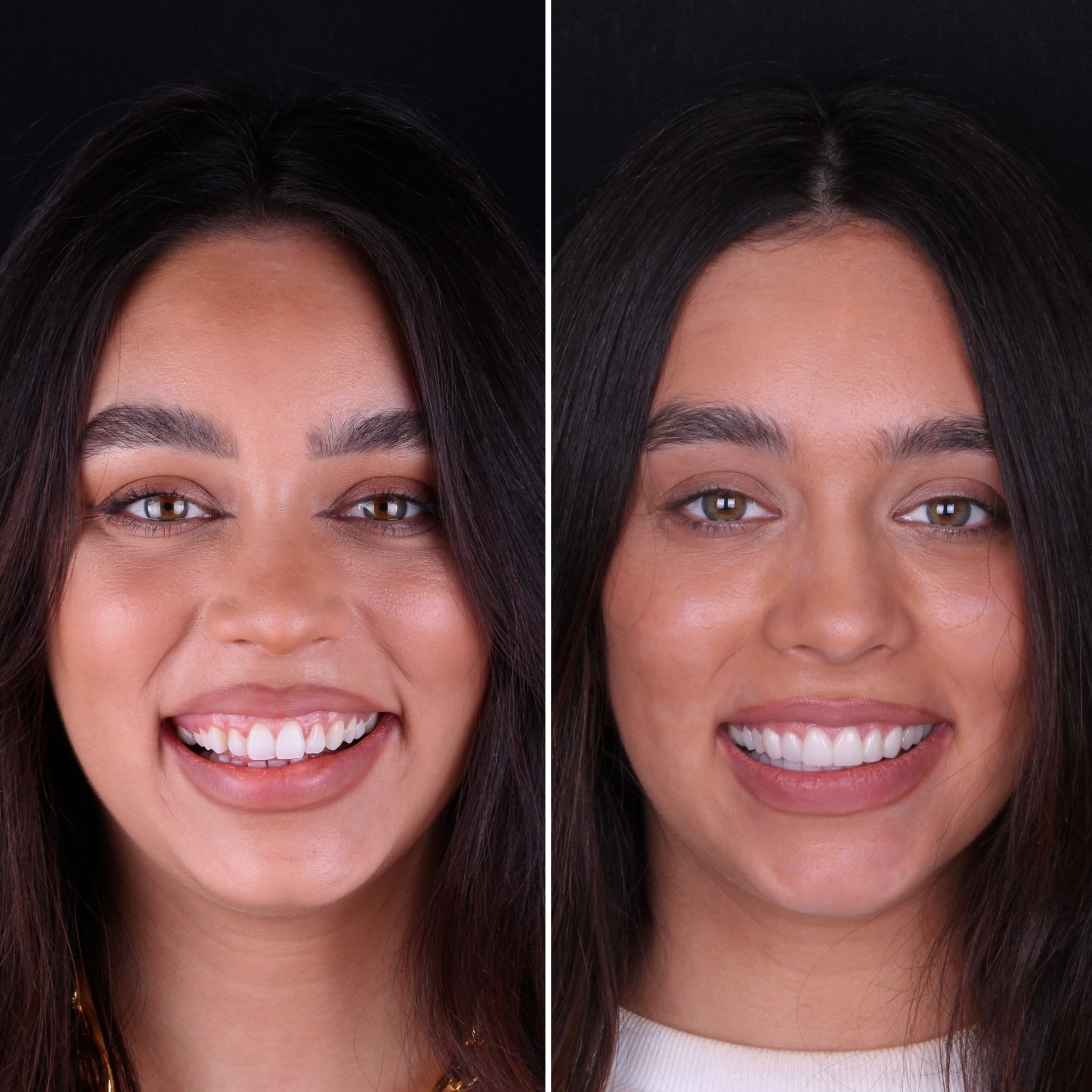 Transcend Specialized Dentistry Gallery